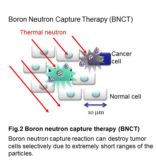 Boron Neutron Capture Therapy